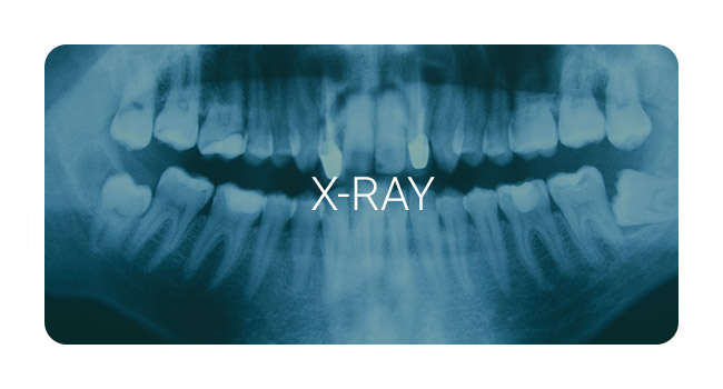 Pediatric Dentist - Dr Tooth Little Dentists Montana, Groenkloof, Centurion